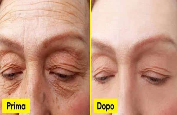 3 Masques à Base de Blanc d’Œufs pour un Visage sans Rides - Zbayl