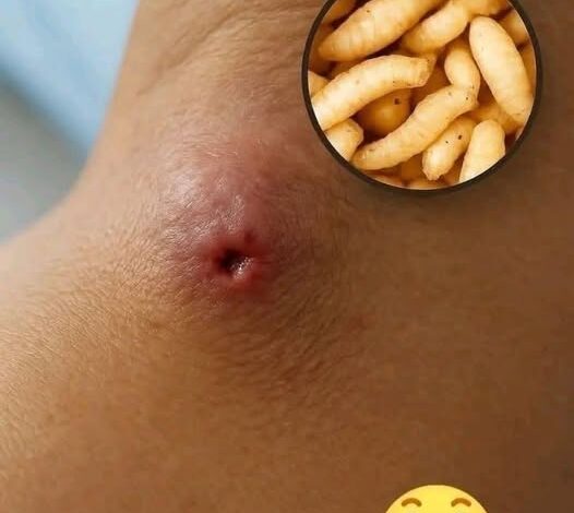 À quoi ressemble le moustique de la dengue ? Découvrez ces 4 conseils ...